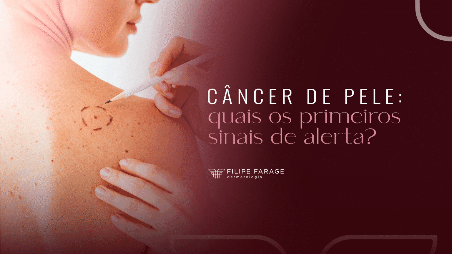 Câncer de pele: quais os primeiros sinais de alerta?